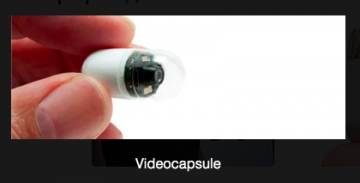 Vidéo-capsule endoscopique : votre intestin fait du cinéma ! • Le ...